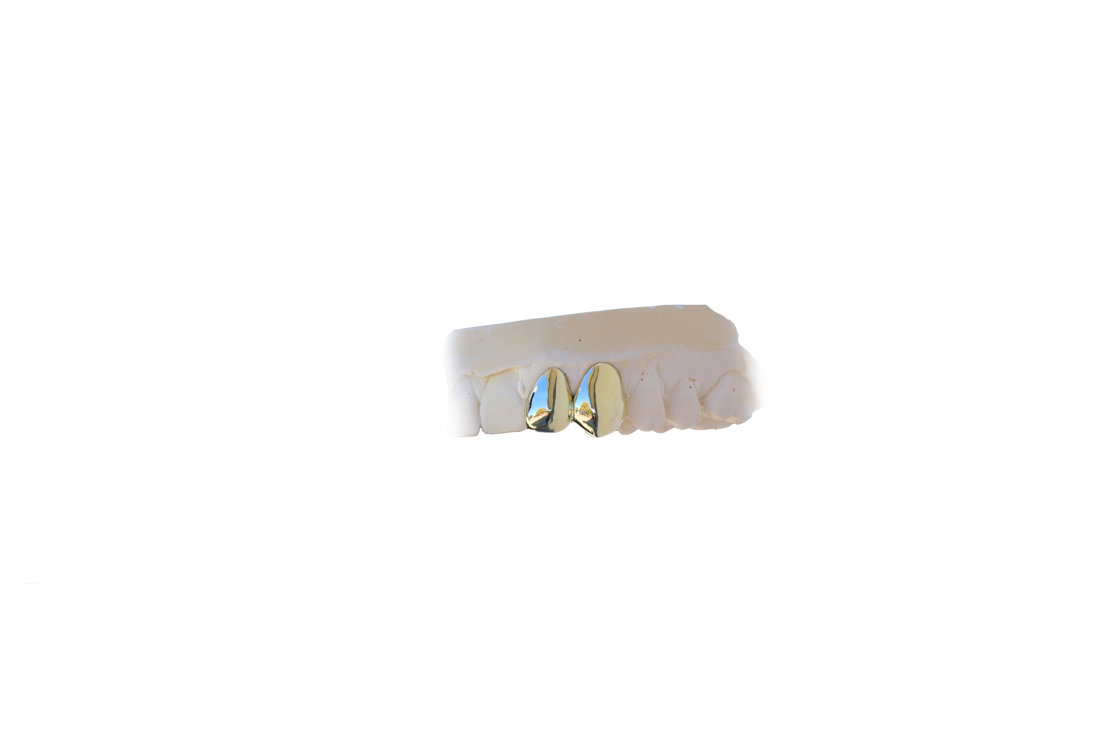 Classic Grillz – GSM Custom Grillz