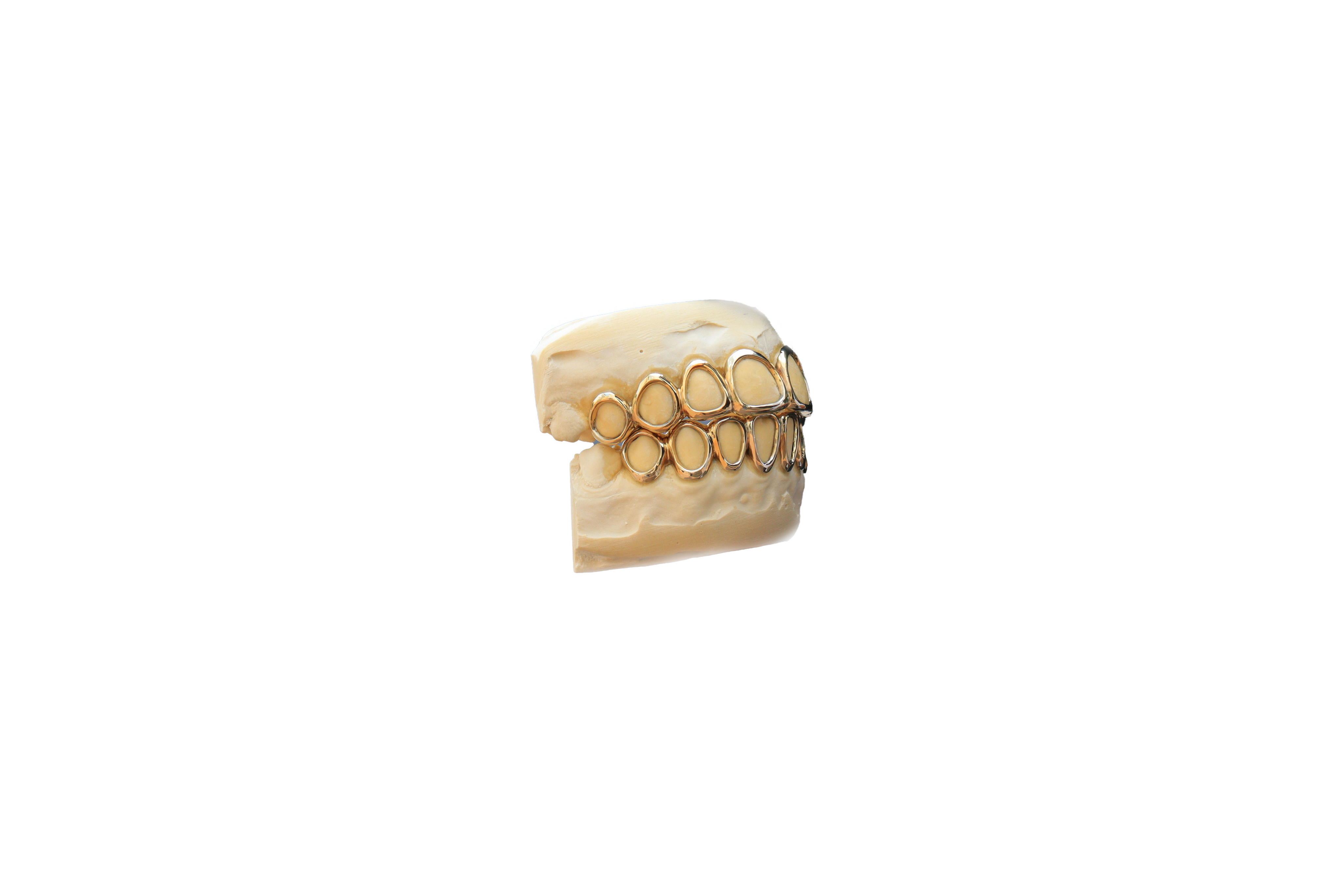 8 Teeth Windows Grillz – GSM Custom Grillz