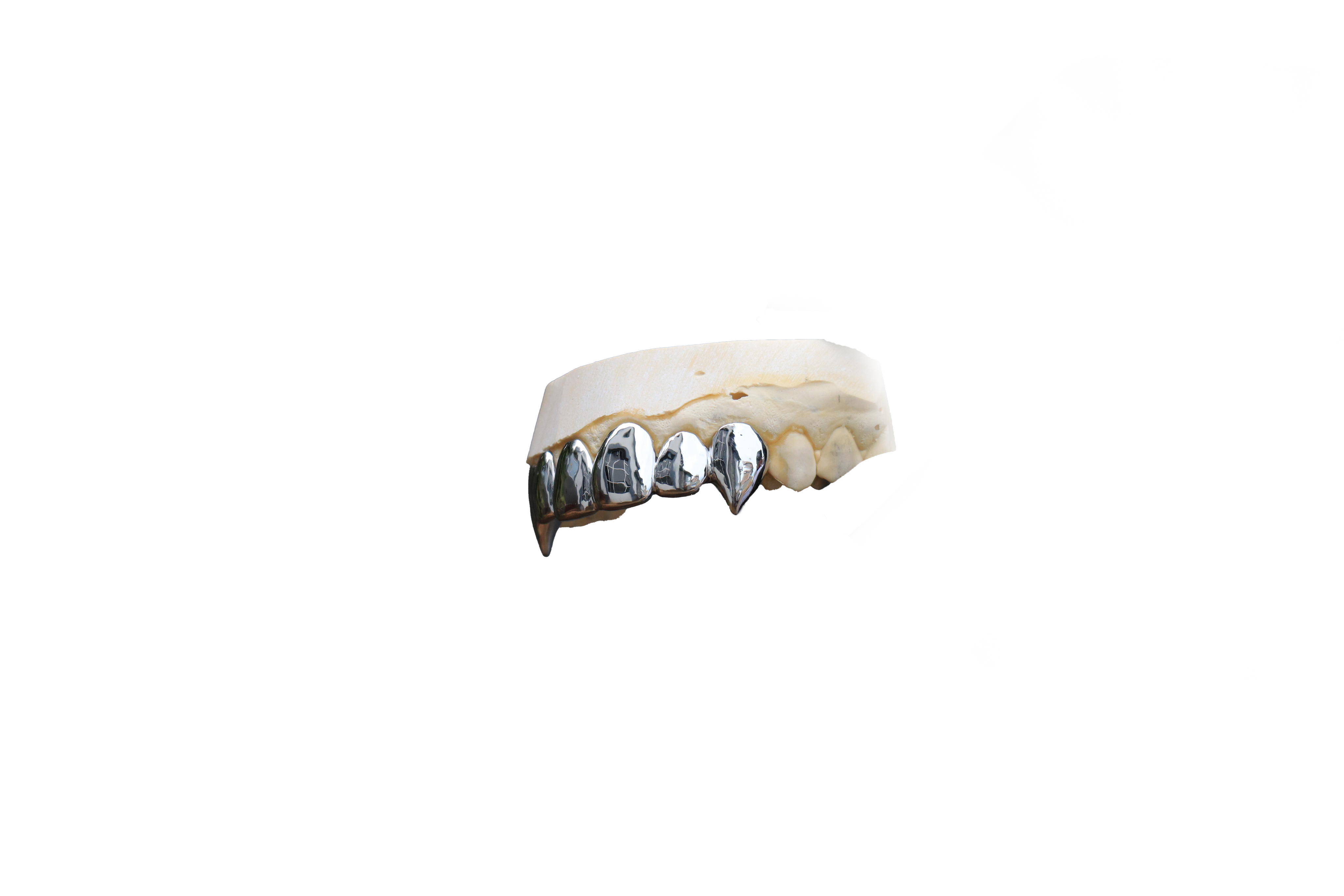 Classic Grillz – GSM Custom Grillz