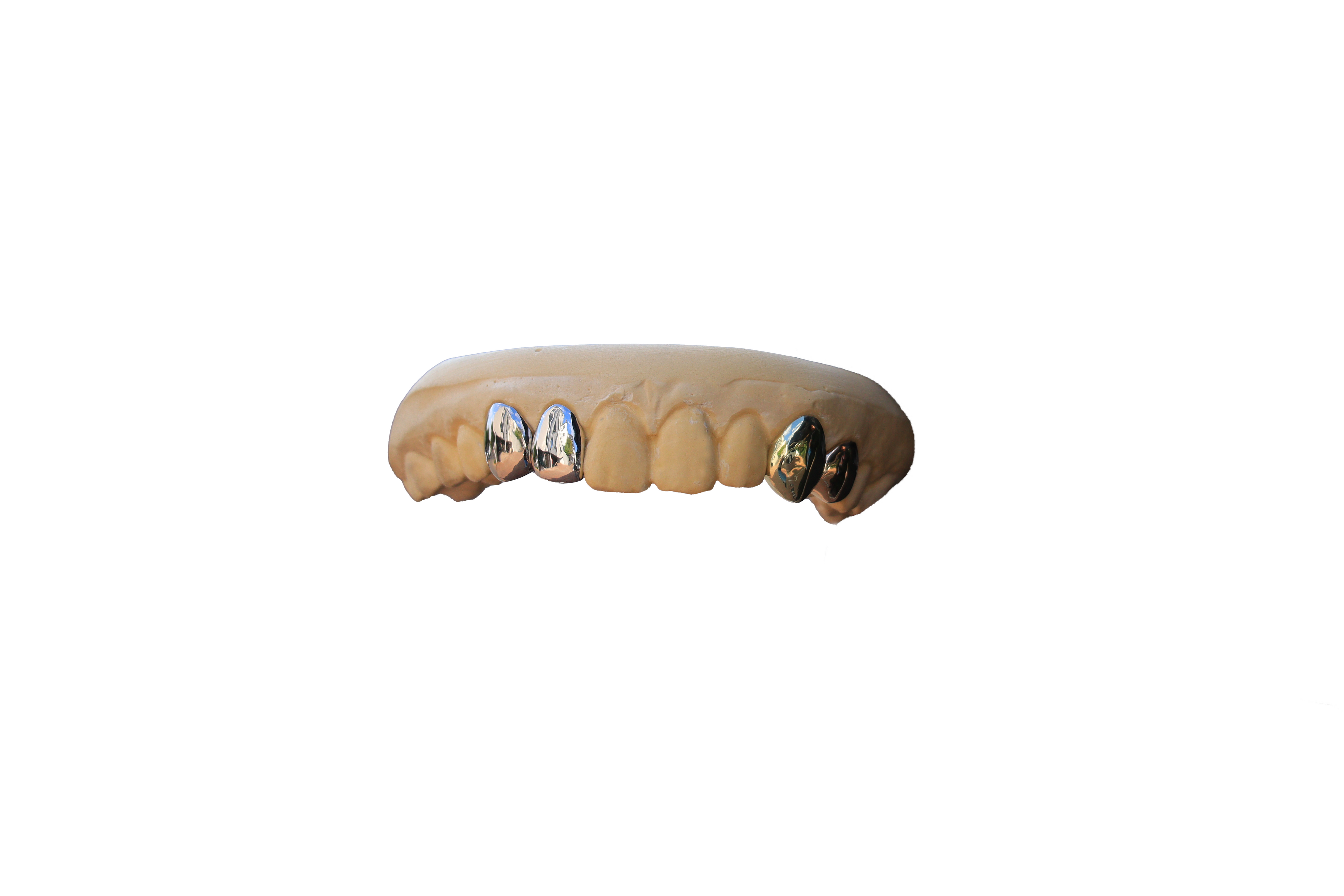 Classic Grillz – GSM Custom Grillz