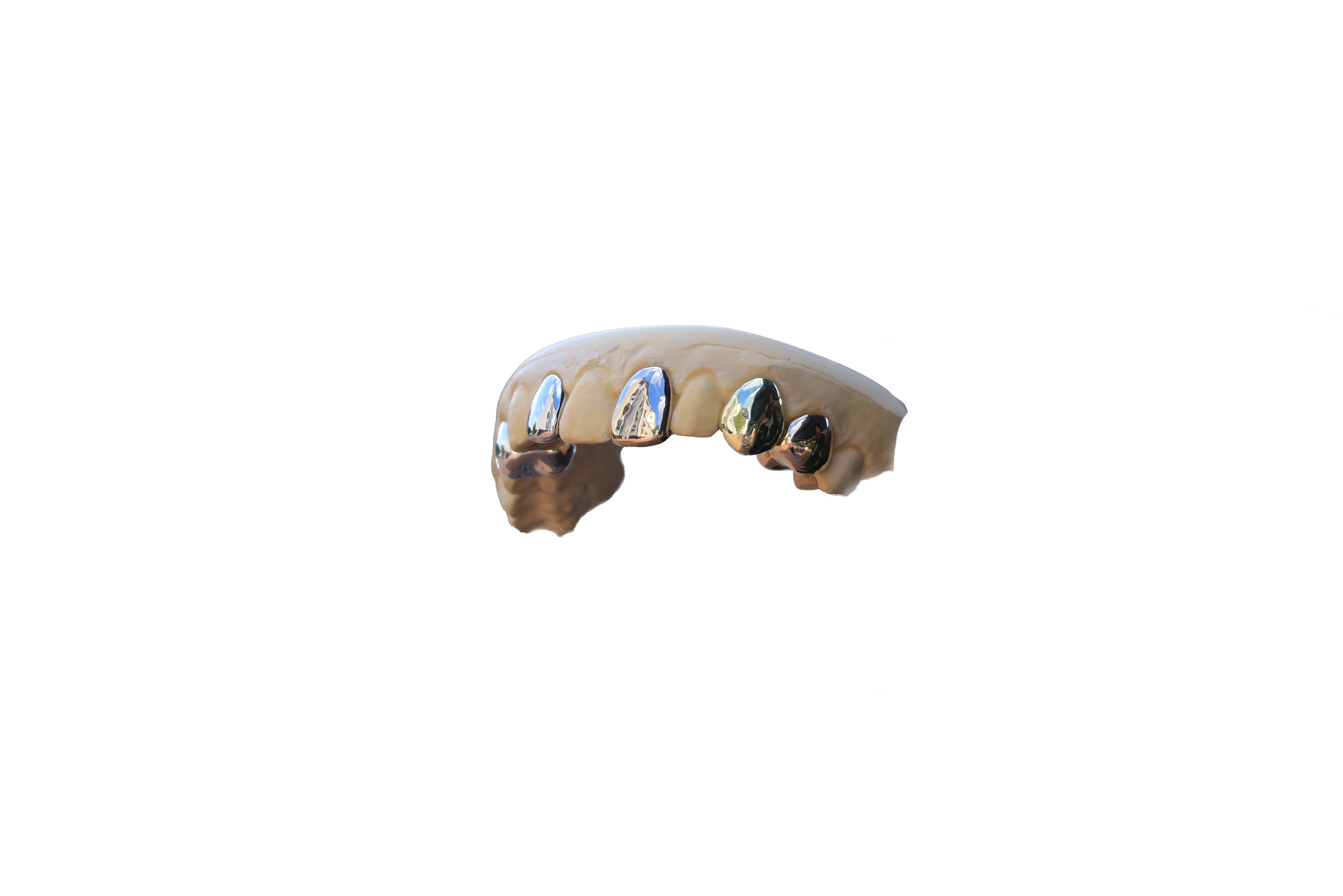 Classic Grillz – GSM Custom Grillz