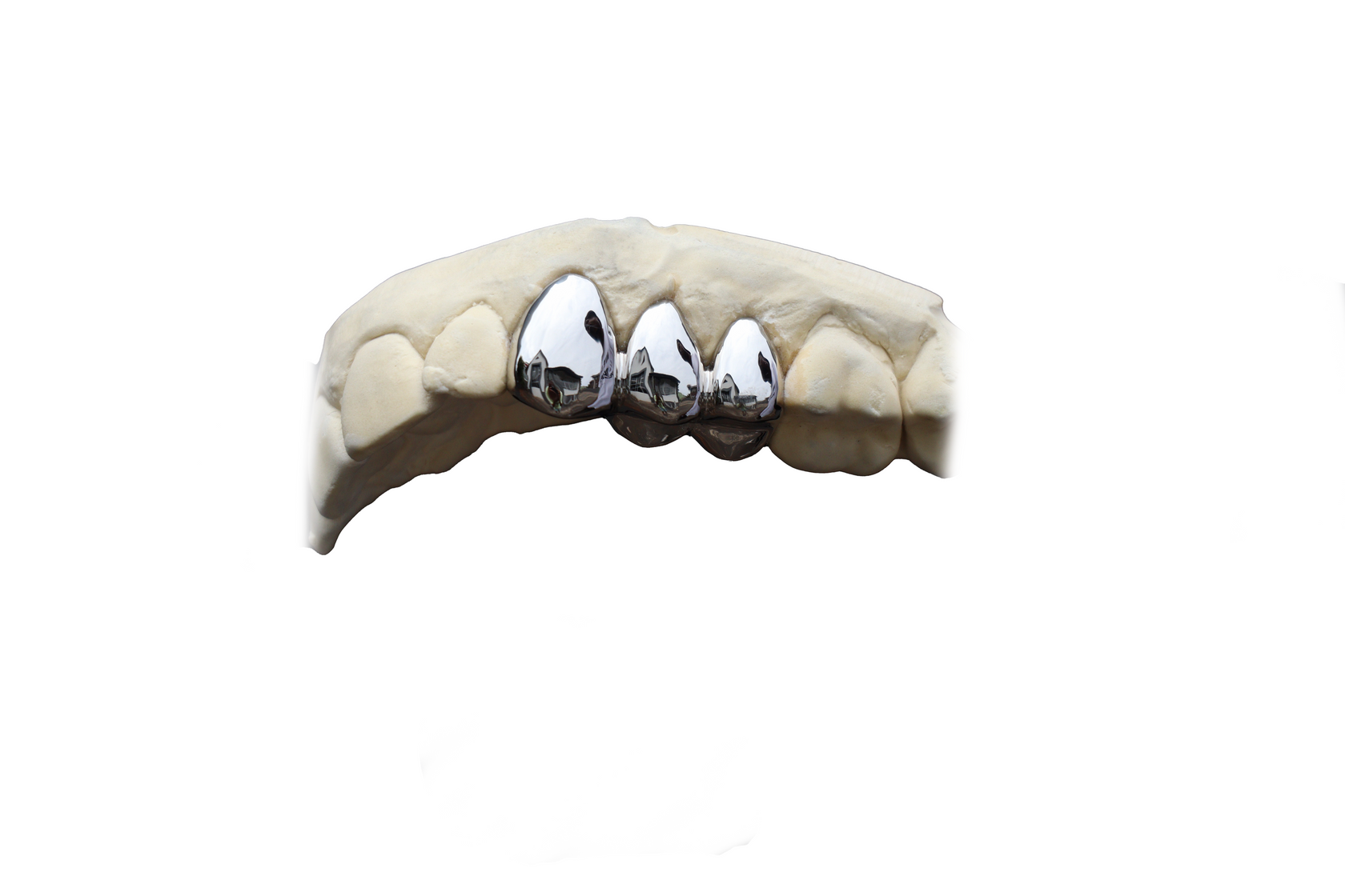 Classic Grillz – GSM Custom Grillz